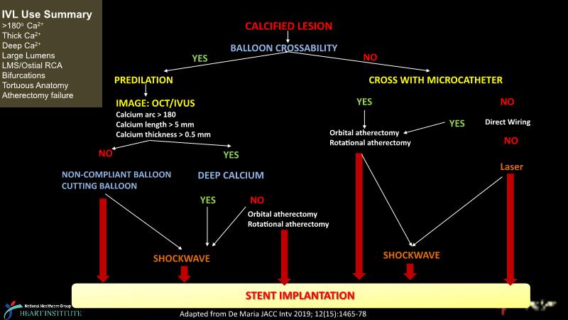 Cracking calcium: best practices to integrate intravascular lithotripsy ...
