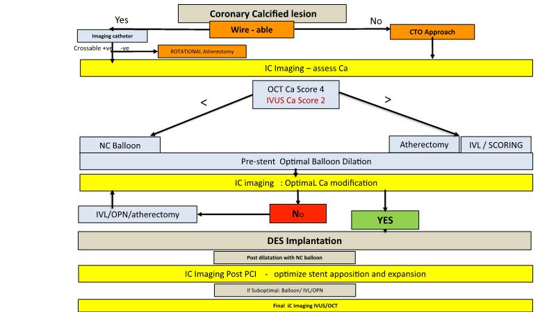 Cracking calcium: best practices to integrate intravascular lithotripsy ...