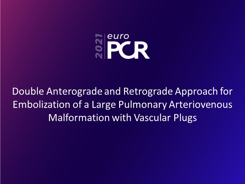 TEVAR for acute ongoing rupture of complicated type B aortic dissection