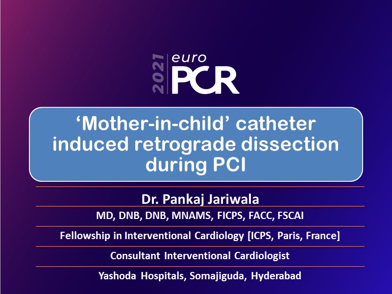 Emergency left main PCI using IVUS guided double-kissing culotte technique