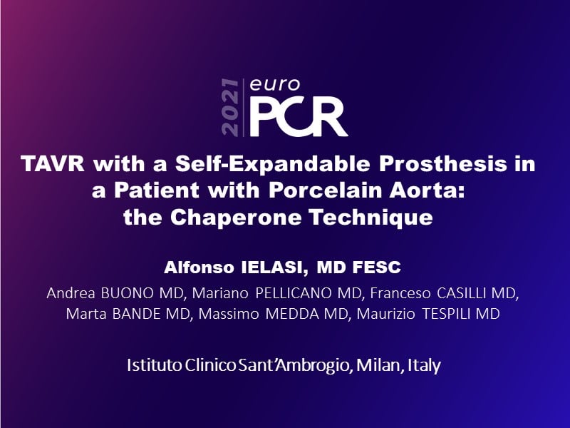 Severe aortic valve stenosis with cardiogenic shock requiring ECMO